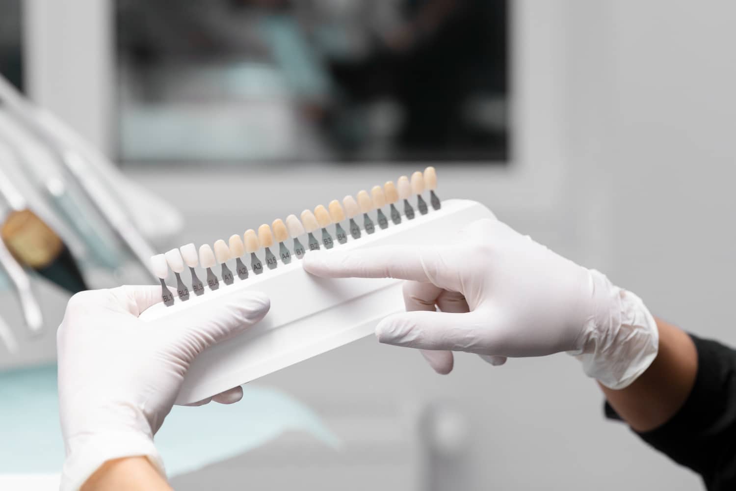 Choosing the Right Shade for Natural-Looking Veneers - Florida Smiles ...