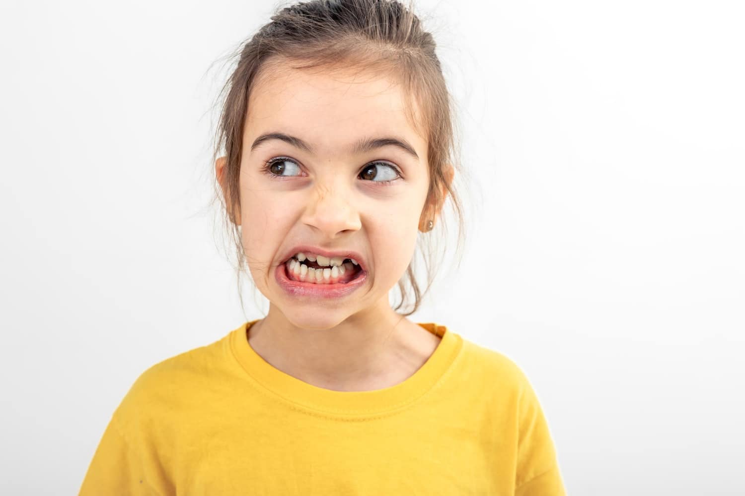 Why Is My Adult Tooth Wiggly? - Florida Smiles Dental